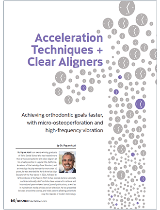 Acceleration Techniques & Clear Aligners | Propel Ortho
