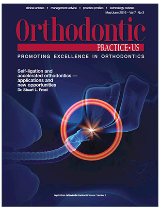 Self-Ligation and Accelerated Orthodontics | Propel Ortho