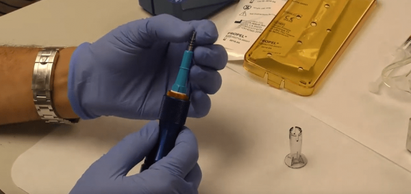 MOPs® Excellerator® PT Tutorial | Propel Orthodontics