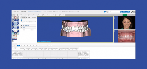Dr. Edward Lin: HFV for All Orthodontic Cases | Propel Ortho