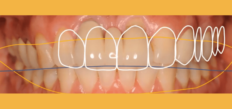 Dr. Thomas Shipley: An Intermediate Course | Propel Ortho