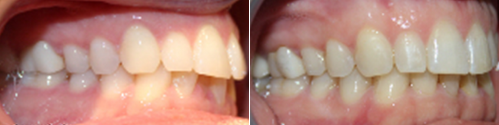 Doctor Spotlight: Bryan Roos | Propel Orthodontics